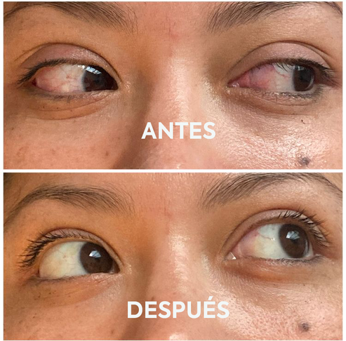 Spa de Ojos – Mei Spa